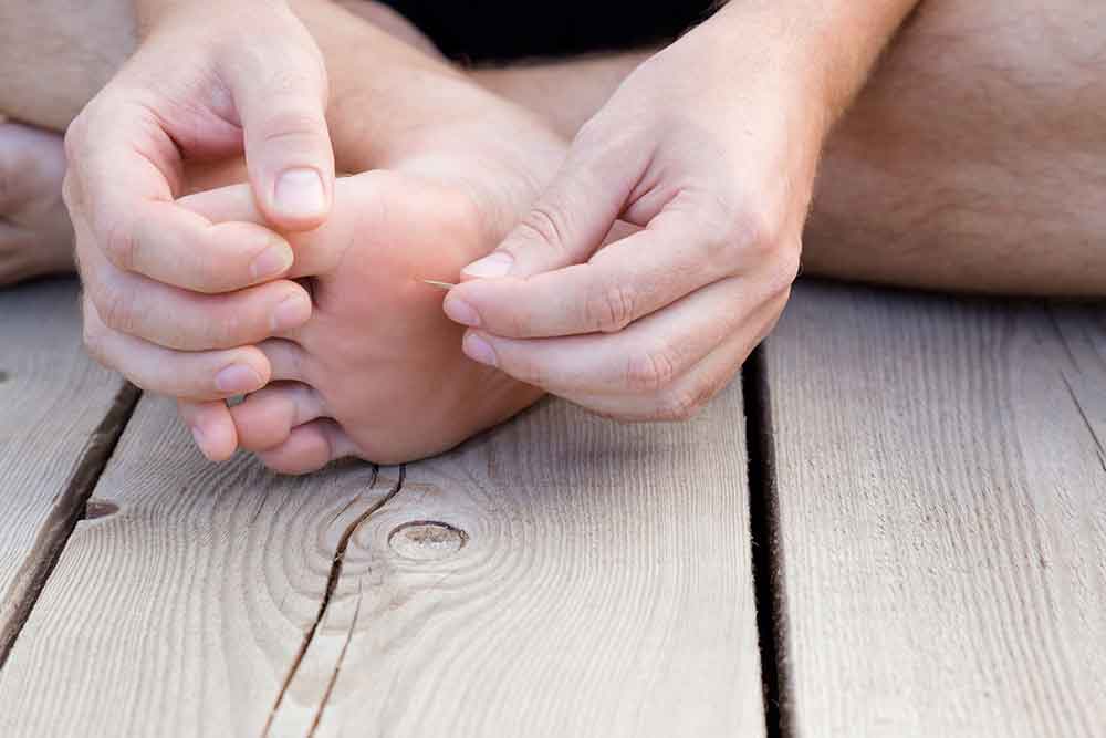 An object embedded in your foot - Camden MSK